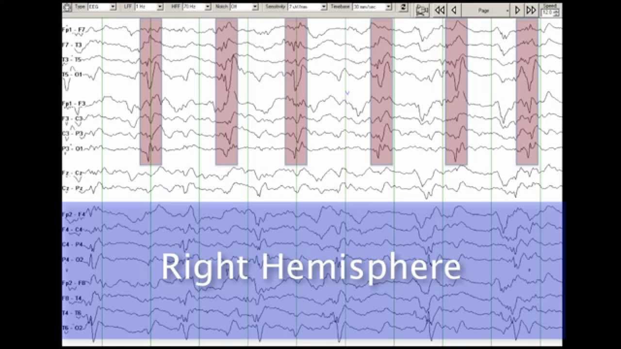 10 Diffuse Slow and PDs - YouTube