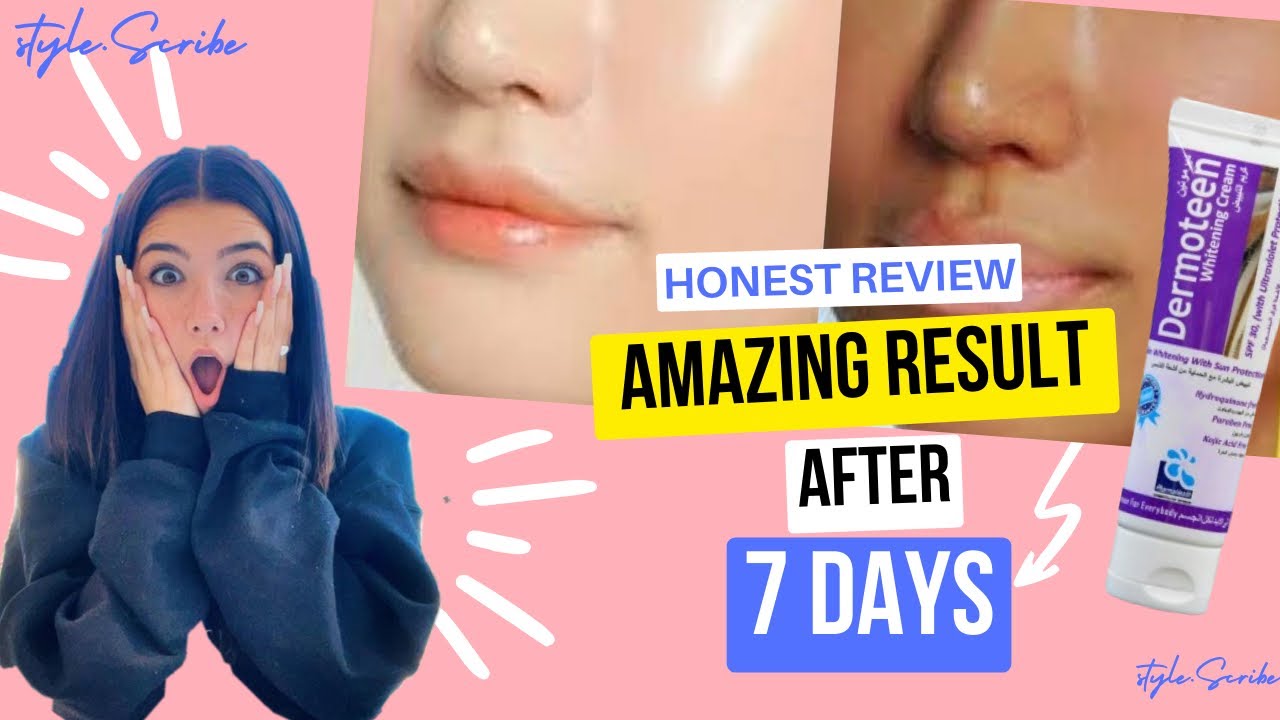 Dermoteen Face Whitening Cream | Medicated Cream with 100% results ...