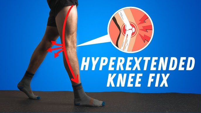 Hyperextended Knee Swelling