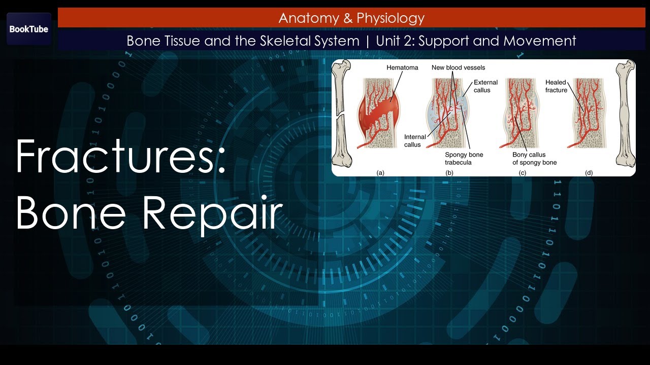 Fractures: Bone Repair | Bone Tissue and the Skeletal System | Unit 2 ...