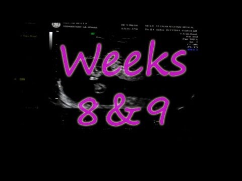 Pregnancy Update: Weeks 8&9 [JaS] - YouTube