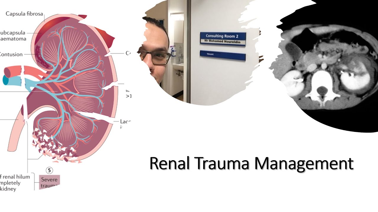 Management of Renal Trauma - YouTube