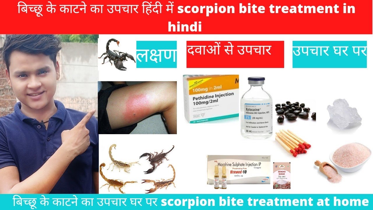 scorpion bite treatment at home in hindi//बिच्छू के काटने का उपचार ...