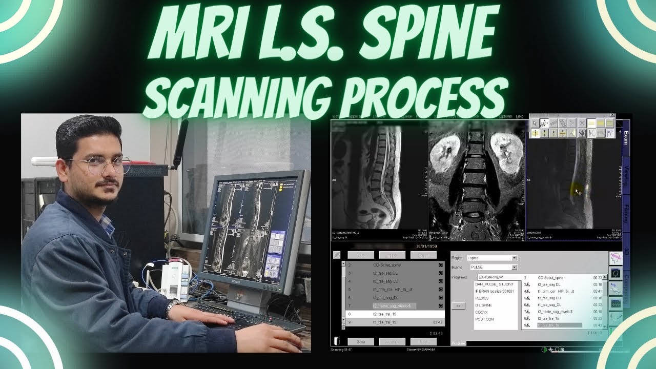 MRI L.S. Spine scanning process | mri lumbosacral spine scan on Siemens ...