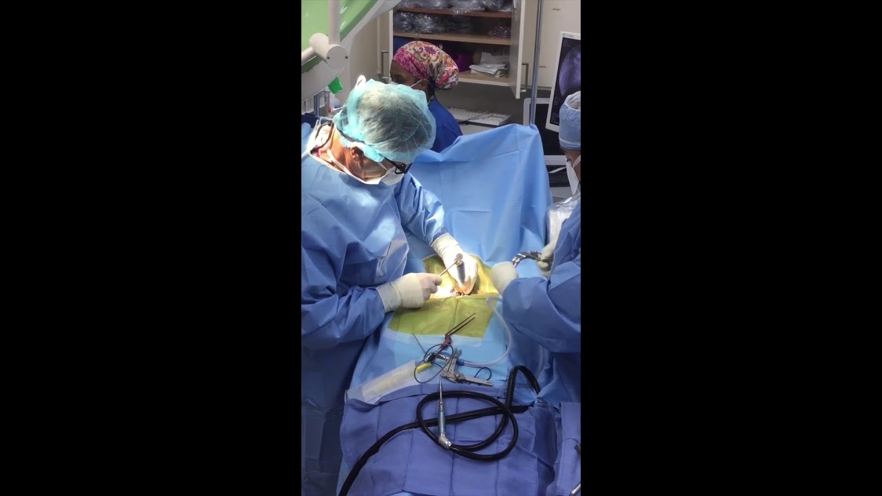 Cervical Disc Replacement with the Mobi-C Implant by Soma Orthopedics ...