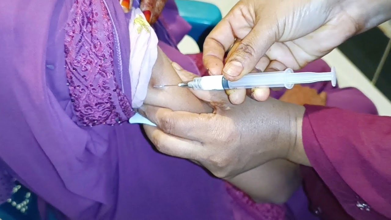 How to Give Arm IM Injection (Soma-Ject) | Family Planning Method | 26 ...