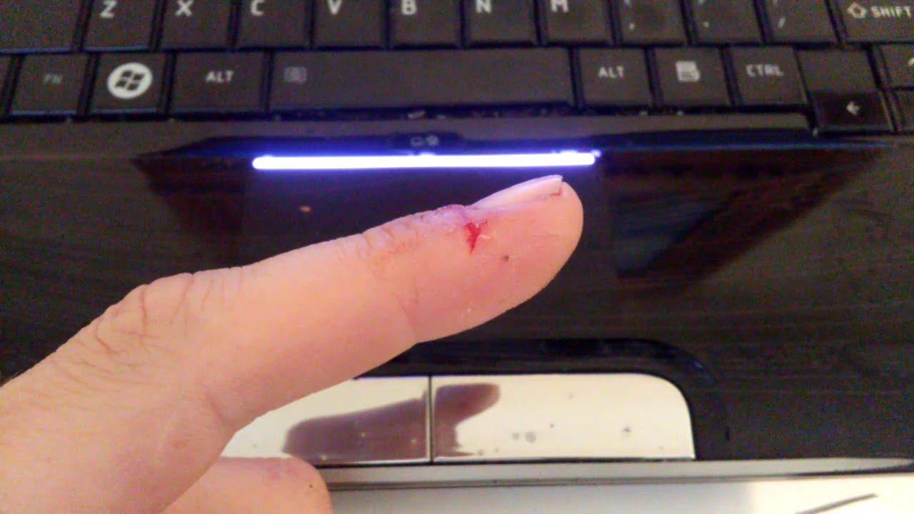 Ouch! Cut my finger today. (groan...) - YouTube