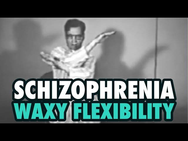 Catatonic Schizophrenia Waxy Flexibility