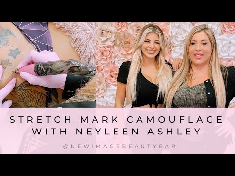 Brazilian Stretch Mark Camouflage with Neyleen Ashley