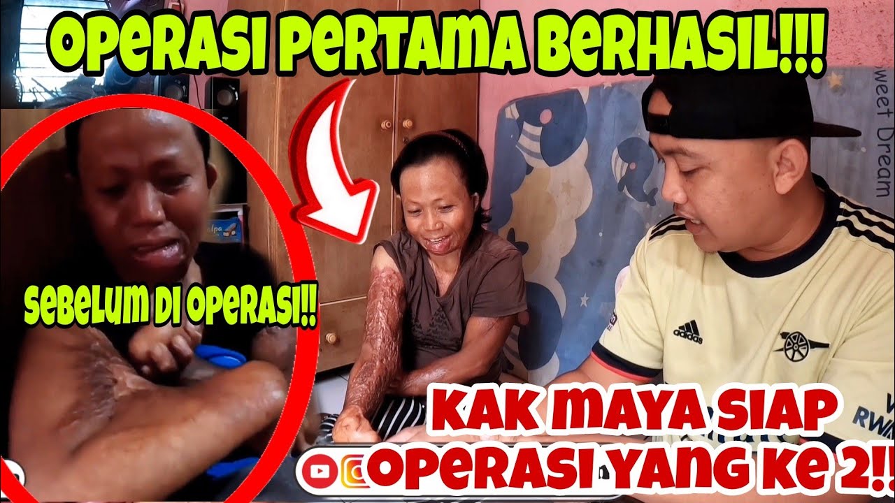 KAK MAYA MAU OPERASI LAGI!!! OPERASI LUKA BAKAR NYA BERHASIL - YouTube