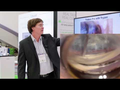 How To Bill Goniotomy With Cataract Surgery