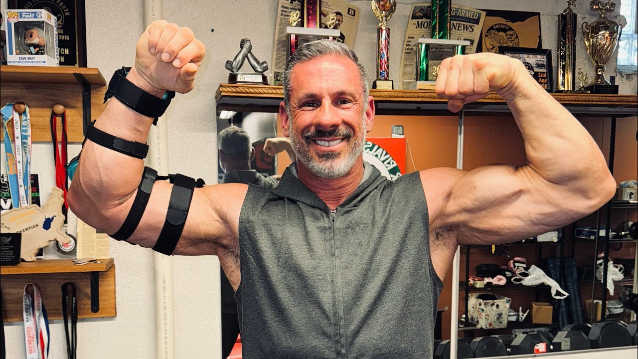 3 weeks post distal bicep surgery. My progress and physical therapy. # ...