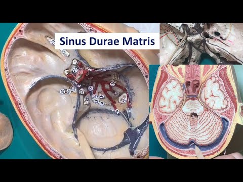 Sinus Durae Matris (Dura Mater Ven Sinusleri)