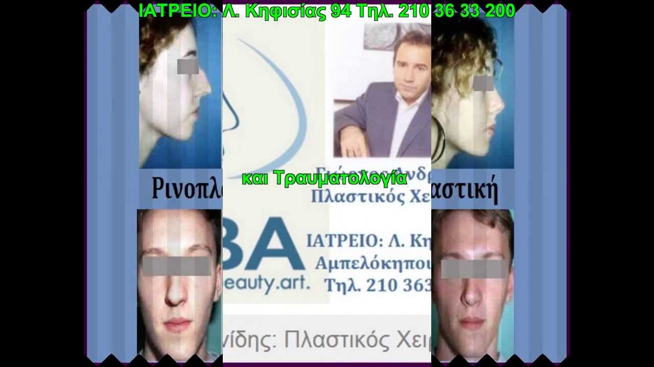 Πλαστικη Χειρουργικη Τιμες Τηλ. 210 36 33 200 - YouTube