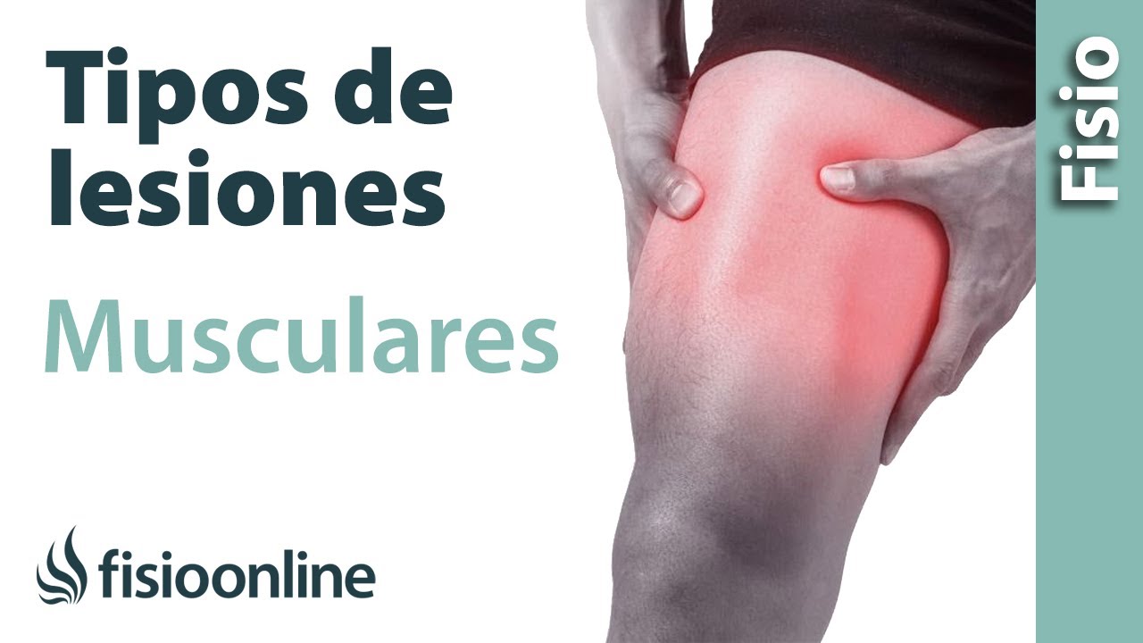 Tipos o grados de LESIONES MUSCULARES y su tratamiento y recuperación ...