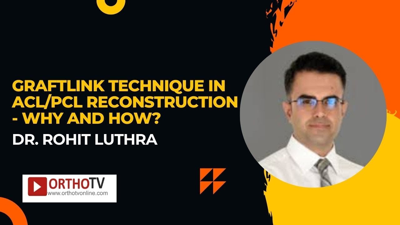 Graftlink Technique in ACL/PCL reconstruction - Why and How? - DR. ROHIT LUTHRA - YouTube