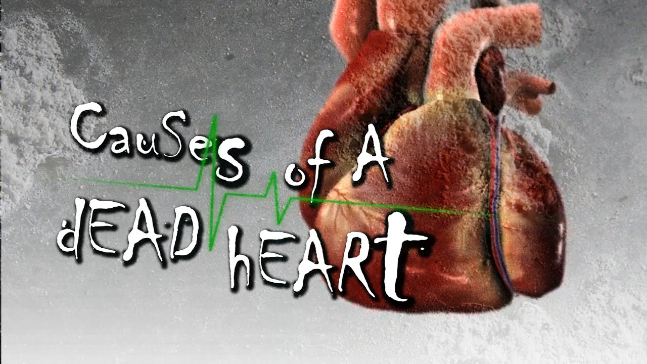 Causes of a DEAD HEART - Powerful Reminder - YouTube