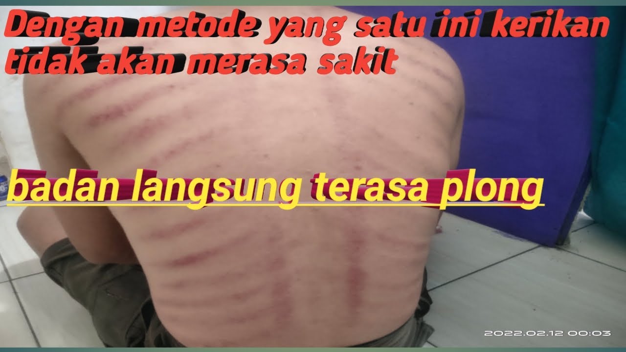 Cara mengatasi masuk angin#terapi#refleksi#pijat - YouTube