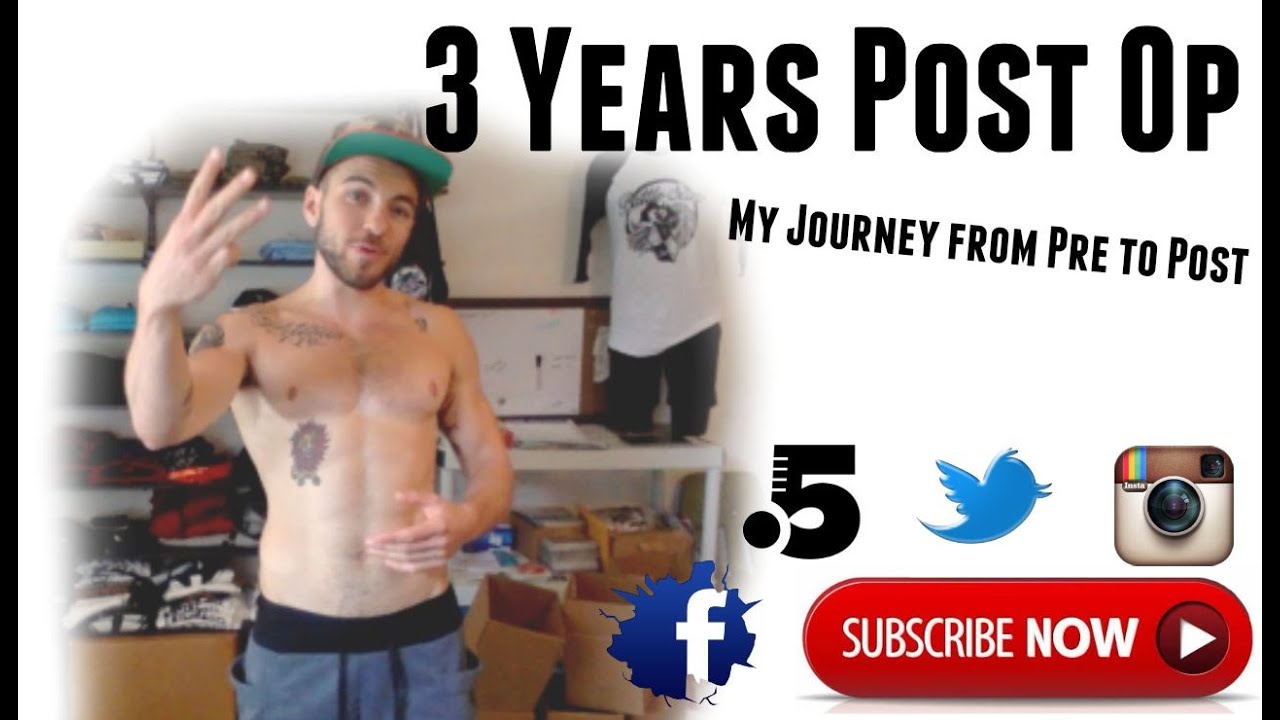 Top Surgery 3 years Post Op2 - YouTube