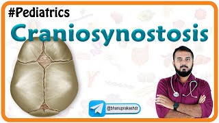 Craniosynostosis : Types Causes Diagnosis and Treatment... | Doovi