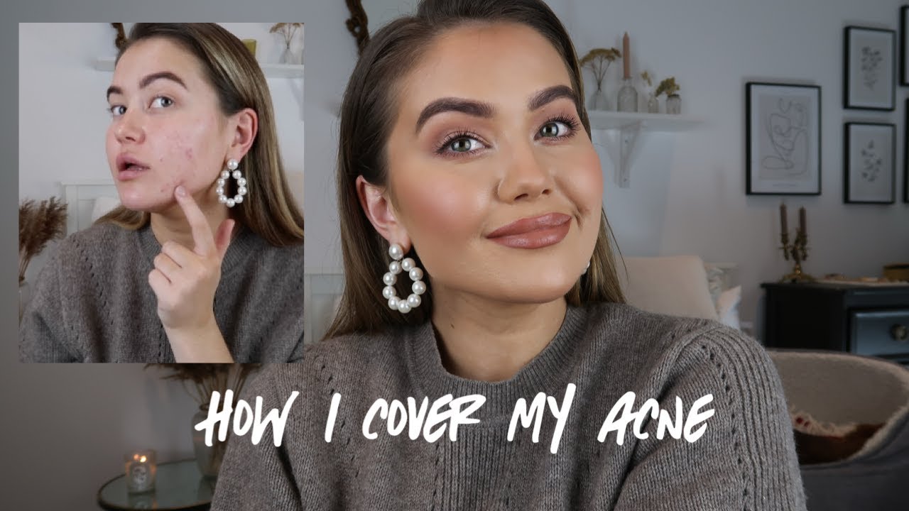 HOW TO COVER ACNE! - YouTube
