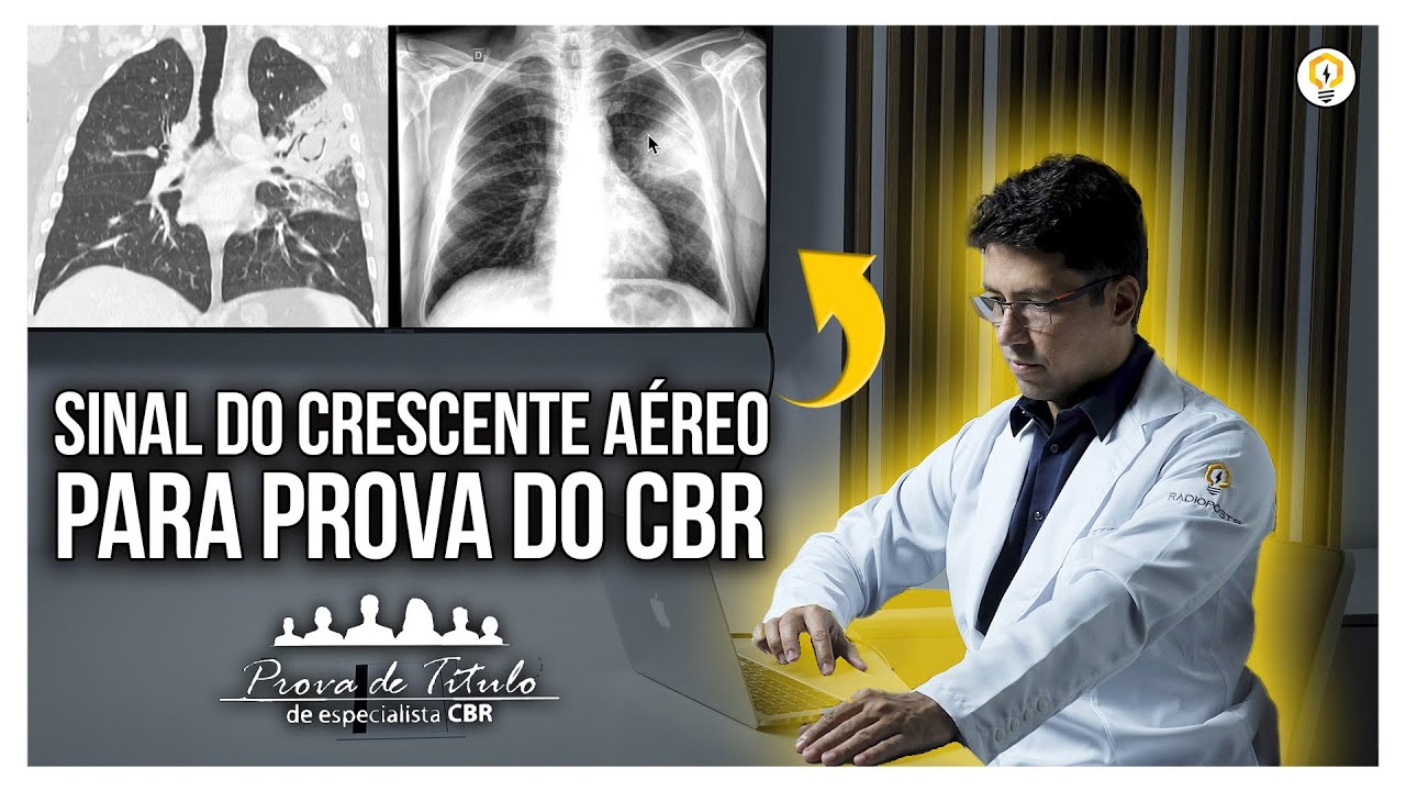 SINAL DO CRESCENTE AÉREO (+ Diferença para o Monod Sign) - YouTube