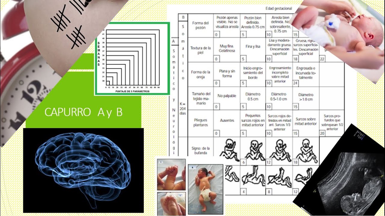 CAPURRO. PRUEBA DE CAPURRO. CALCULO DE EDAD GESTACIONAL - YouTube
