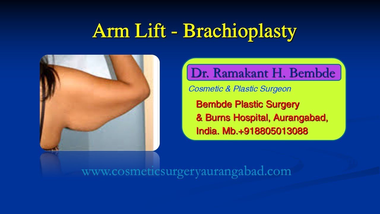 Arm Lift or Brachioplasty with scarless Liposuction & Lipoplasty for ...