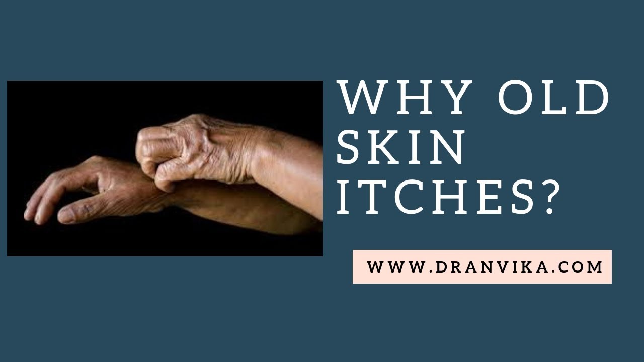 SKIN ITCHING IN OLD AGE - YouTube
