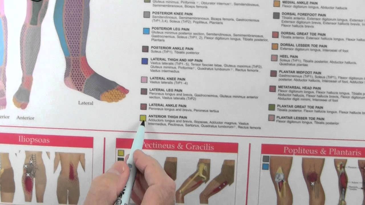 Lower Extremity Trigger Point Chart - YouTube