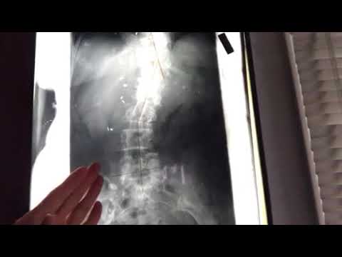 Batchelor Chiropractic Clinic, Dr Dan Batchelor - YouTube
