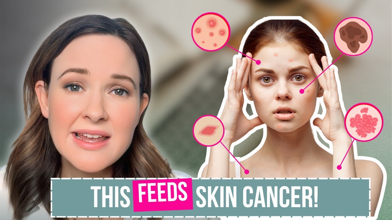 Understanding Skin Cancer: Diagnosis, Types, & Treatment Options ...