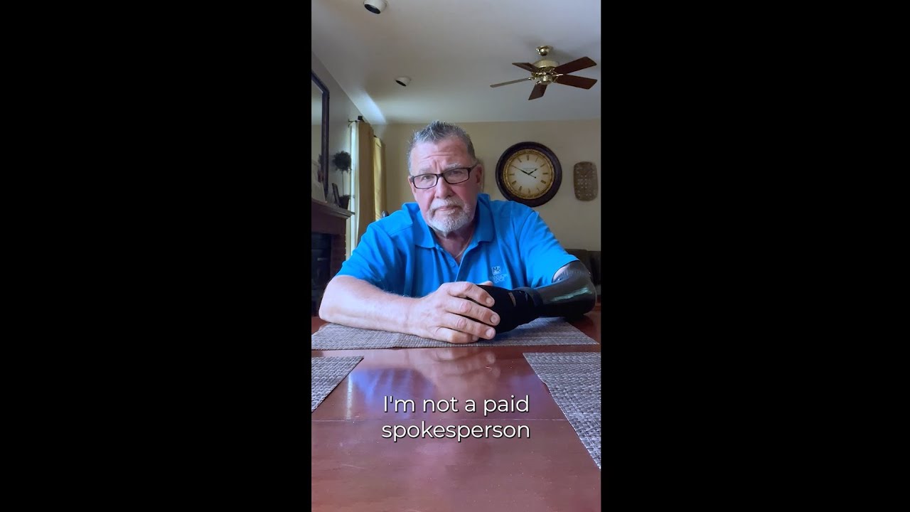 Zeus Bionic Hand User Testimonial - YouTube