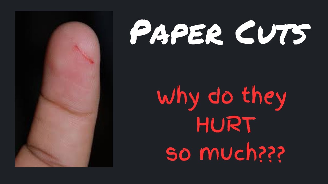 The Shocking Reason a Tiny Paper Cut Hurts So Badly - YouTube
