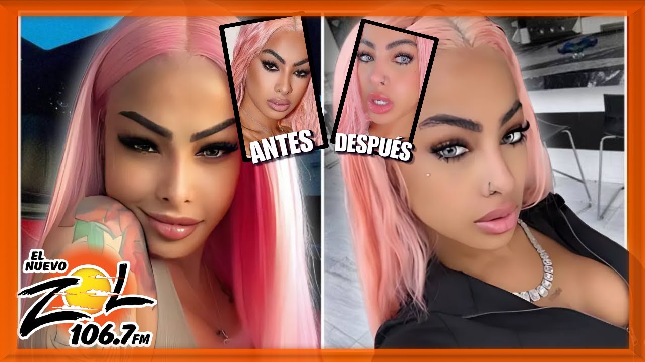 Yailin ‘La Más Viral’ Impacta con Su Nuevo Color de Ojos Tras Cirugía ...