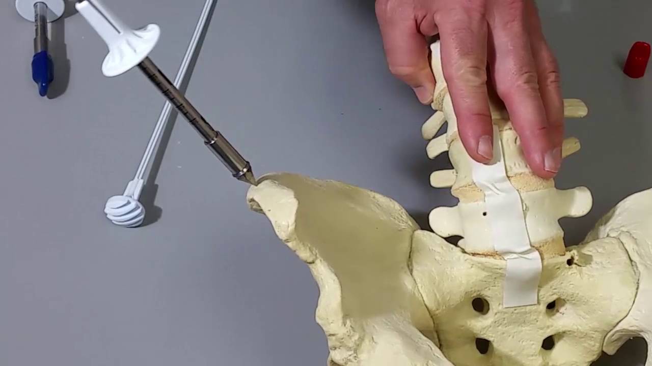 Corex Bone Harvester, Anterior Crest Approach - YouTube