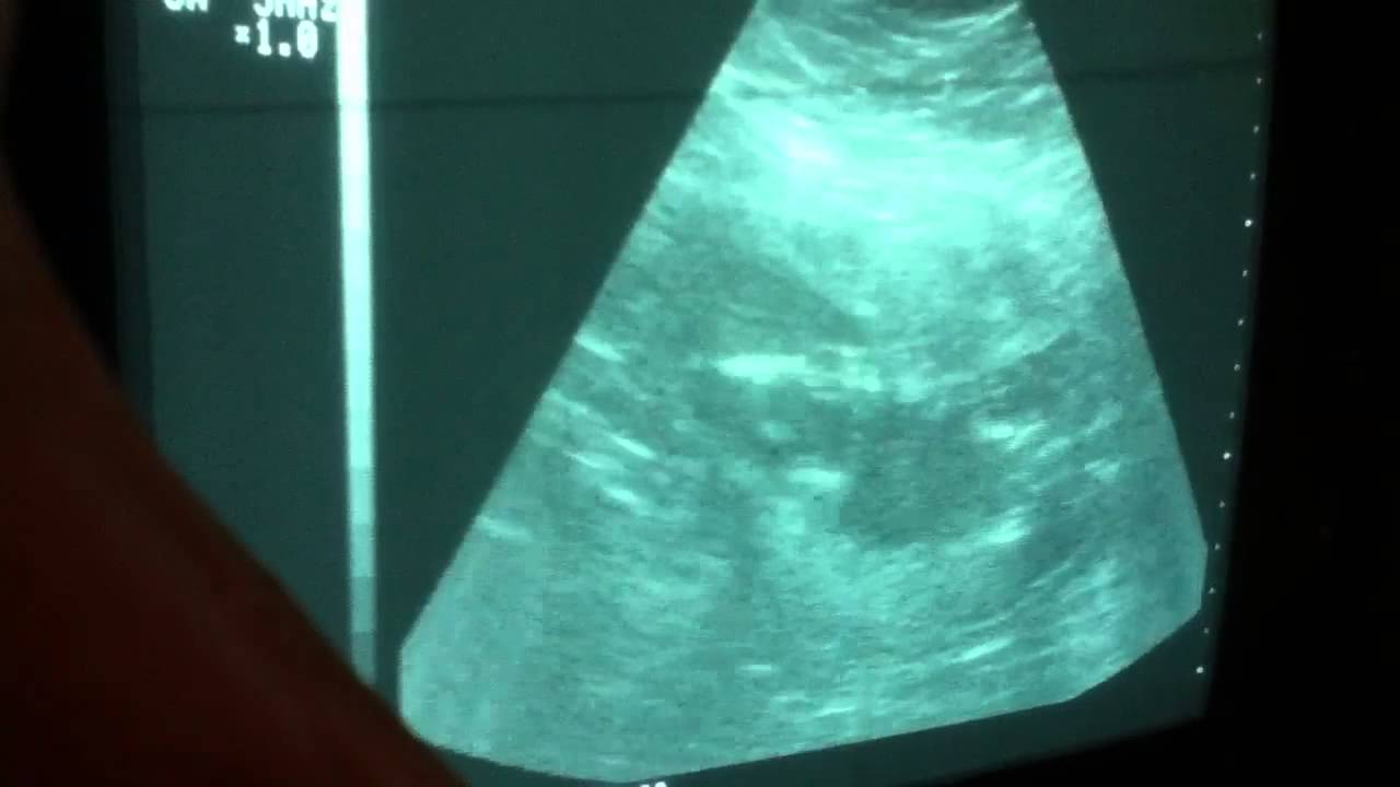 Nuestro bebe esta bien grandote tiene 4meses - YouTube