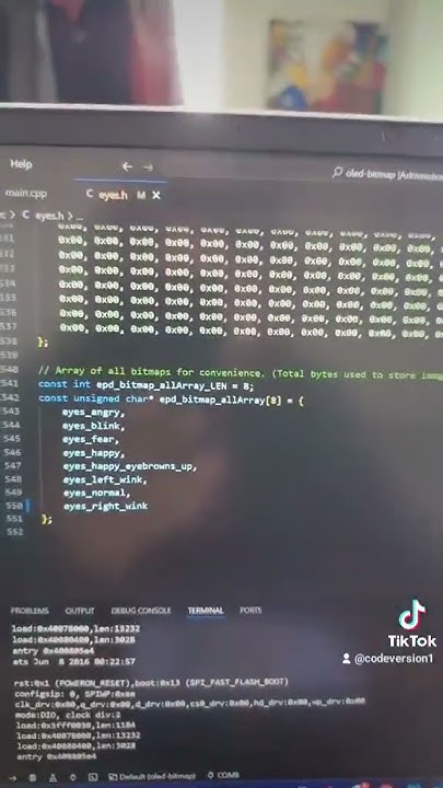 Display OLED and ESP32. Eyes animation - YouTube