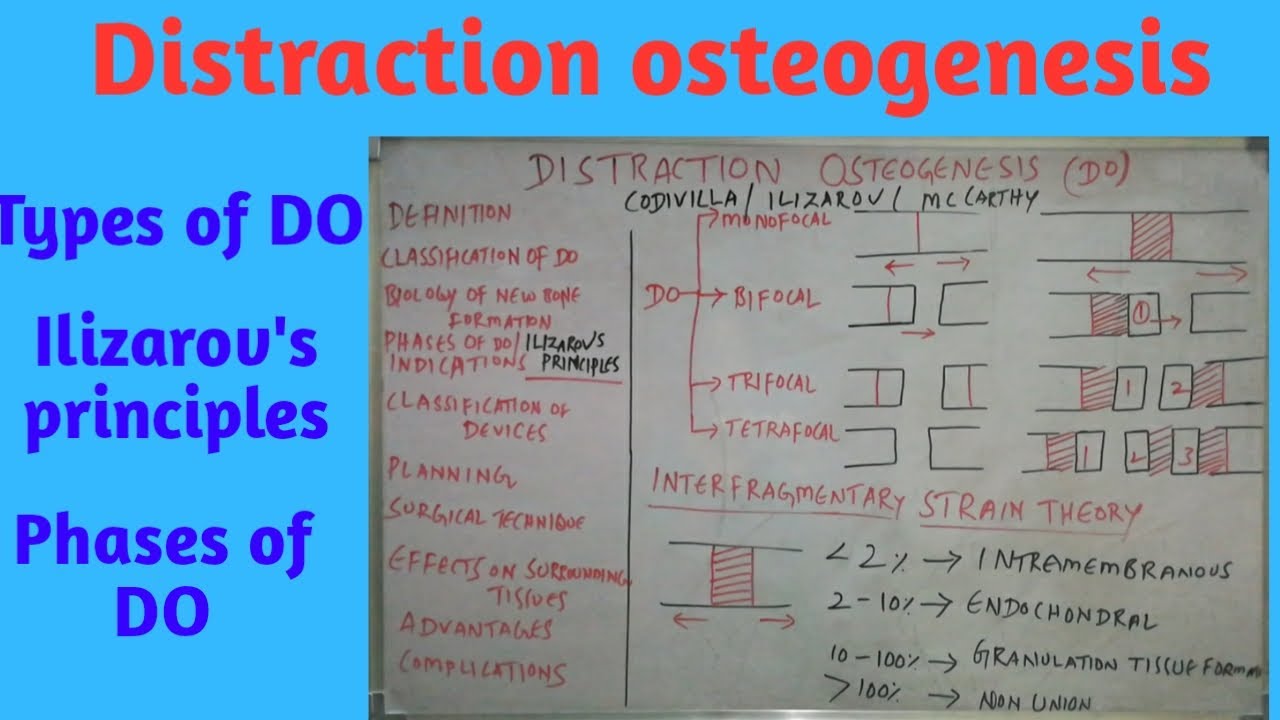 Distraction Osteogenesis part-I - YouTube