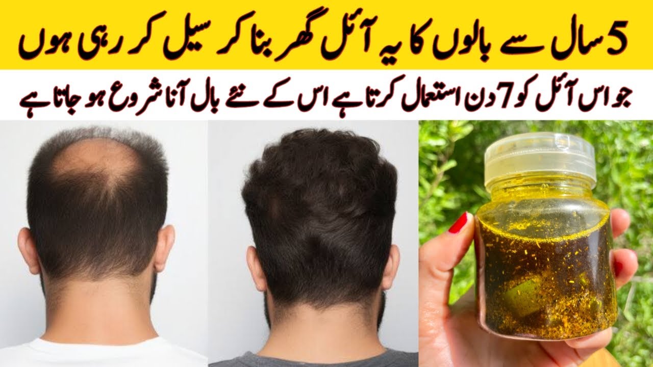 Hair Oil Remedy By Annayas kitchen | Hair Fall Solution At Home | Hair ...