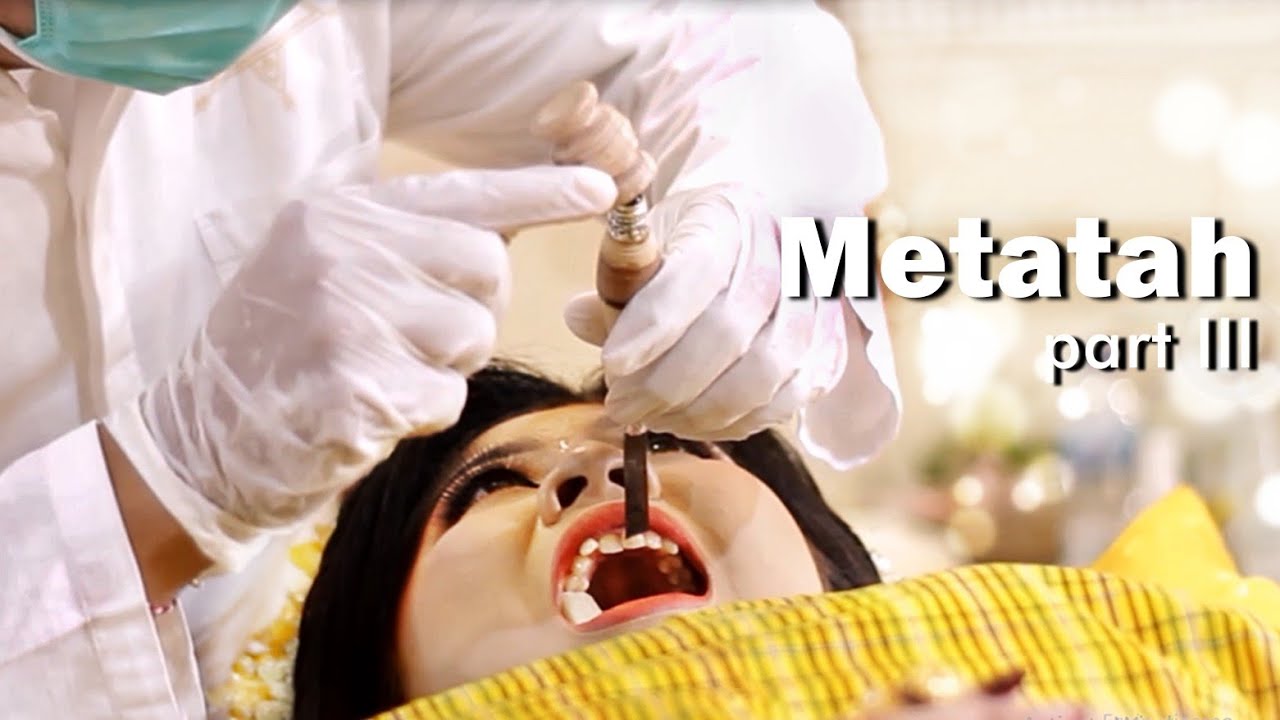 Metatah || Balinese Tooth-filing Ceremony - YouTube