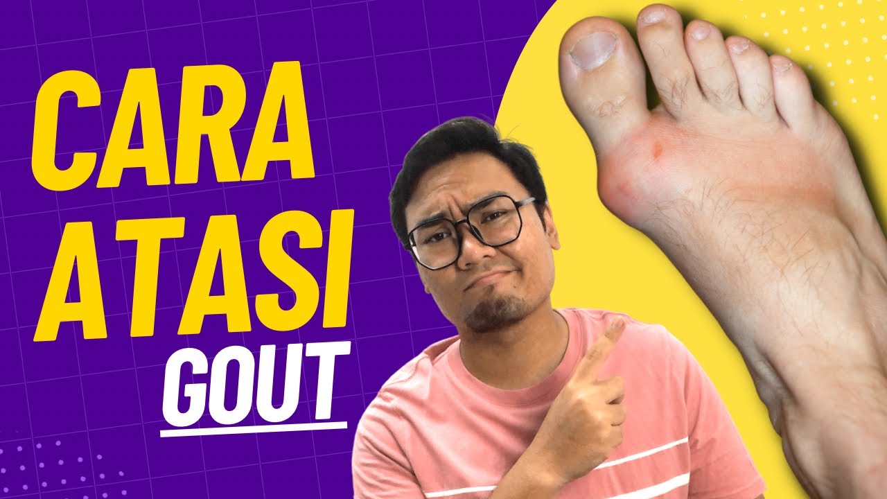 SAKIT GOUT dan Sembuh Dengan Vitamin Semulajadi - YouTube