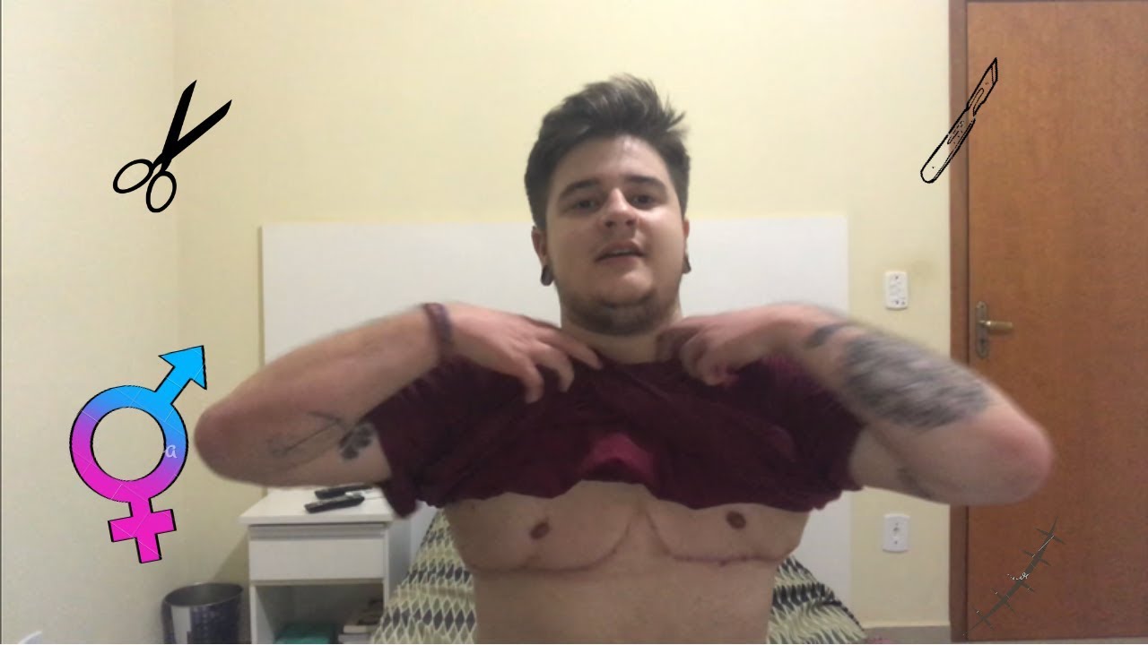 Como foi o processo da mastectomia? - YouTube