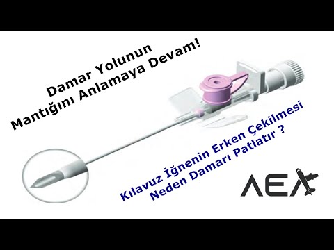 Damar Yolunun Mantığı - 2 (Kılavuz İğne Erken Çekilirse Neden Damar Patlıyor?