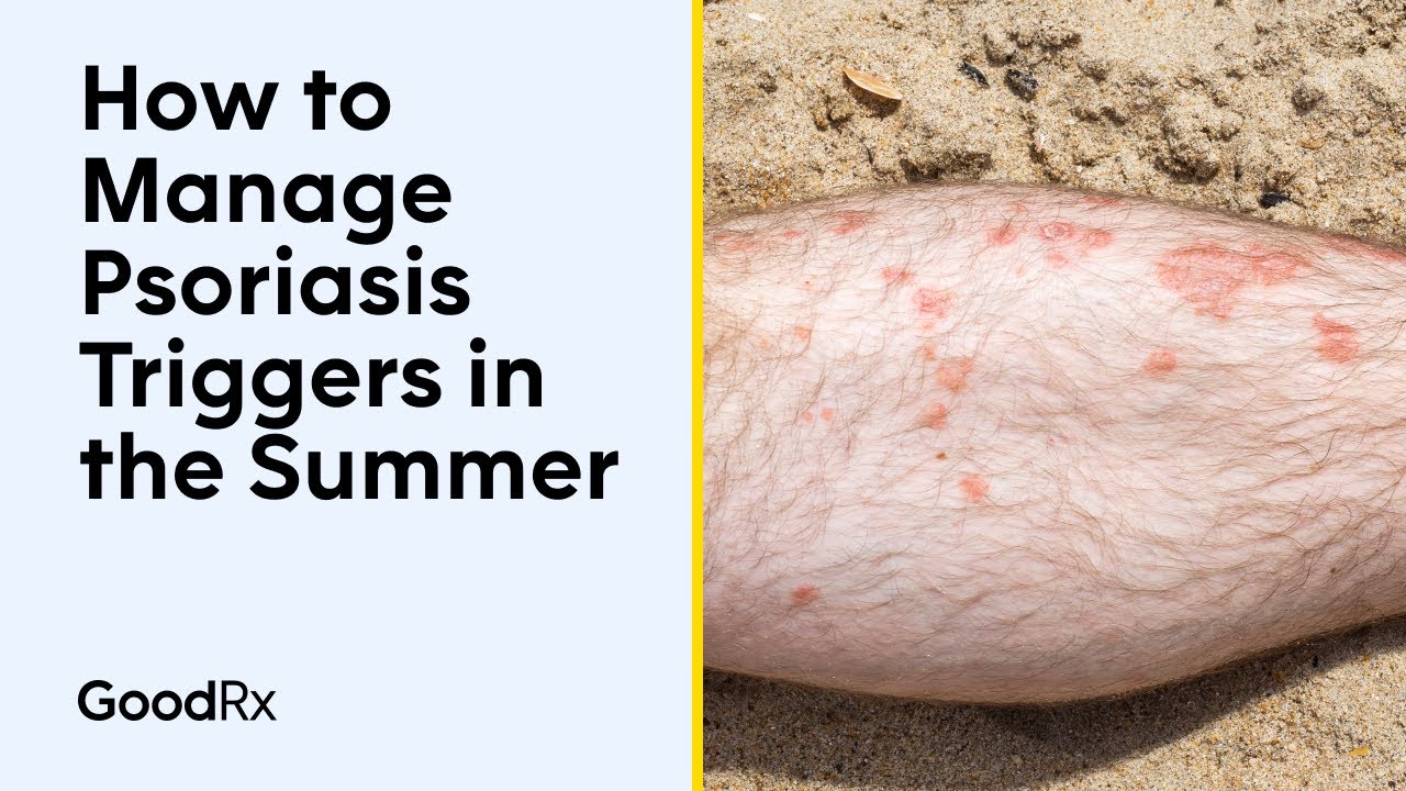 How to Manage Psoriasis Triggers in the Summer | GoodRx - YouTube