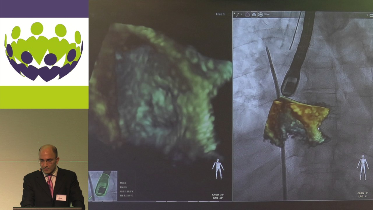 Adel Aminian - From theory to practice, practical approaches for image ...