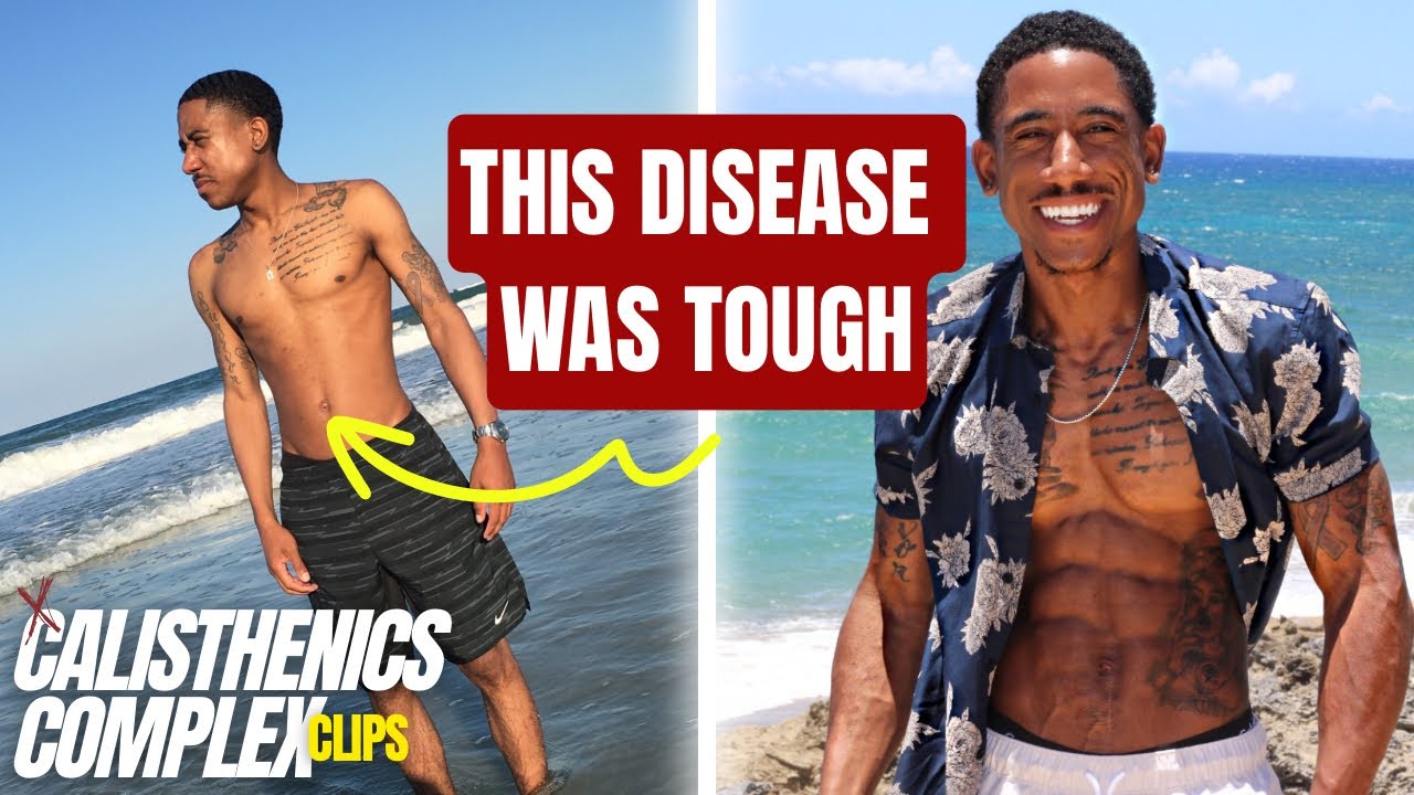 My Crohn's Story: From 89 Pounds to Thriving! - YouTube