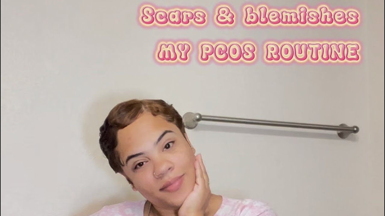 PCOS & HYPERPIGMENTATION - KOREAN SKINCARE - YouTube