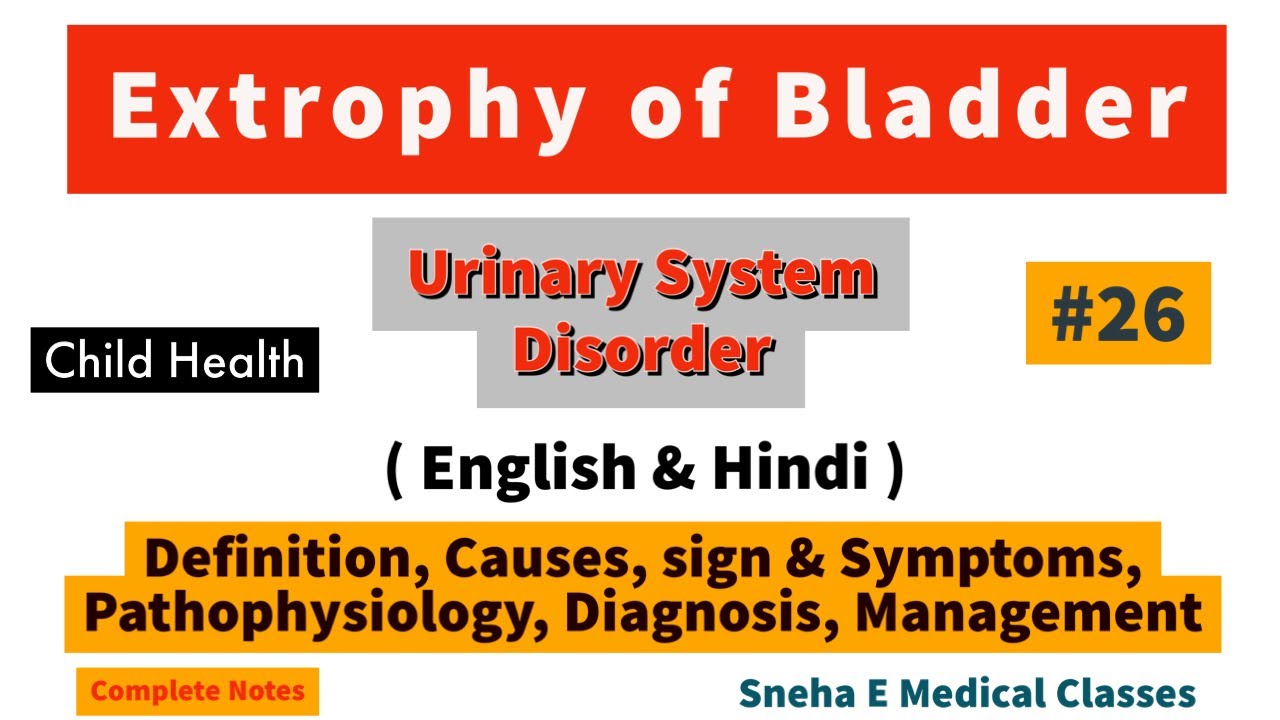 Extropy ( Extrophy of Bladder ) in Hindi || Urinary disorders !! - YouTube