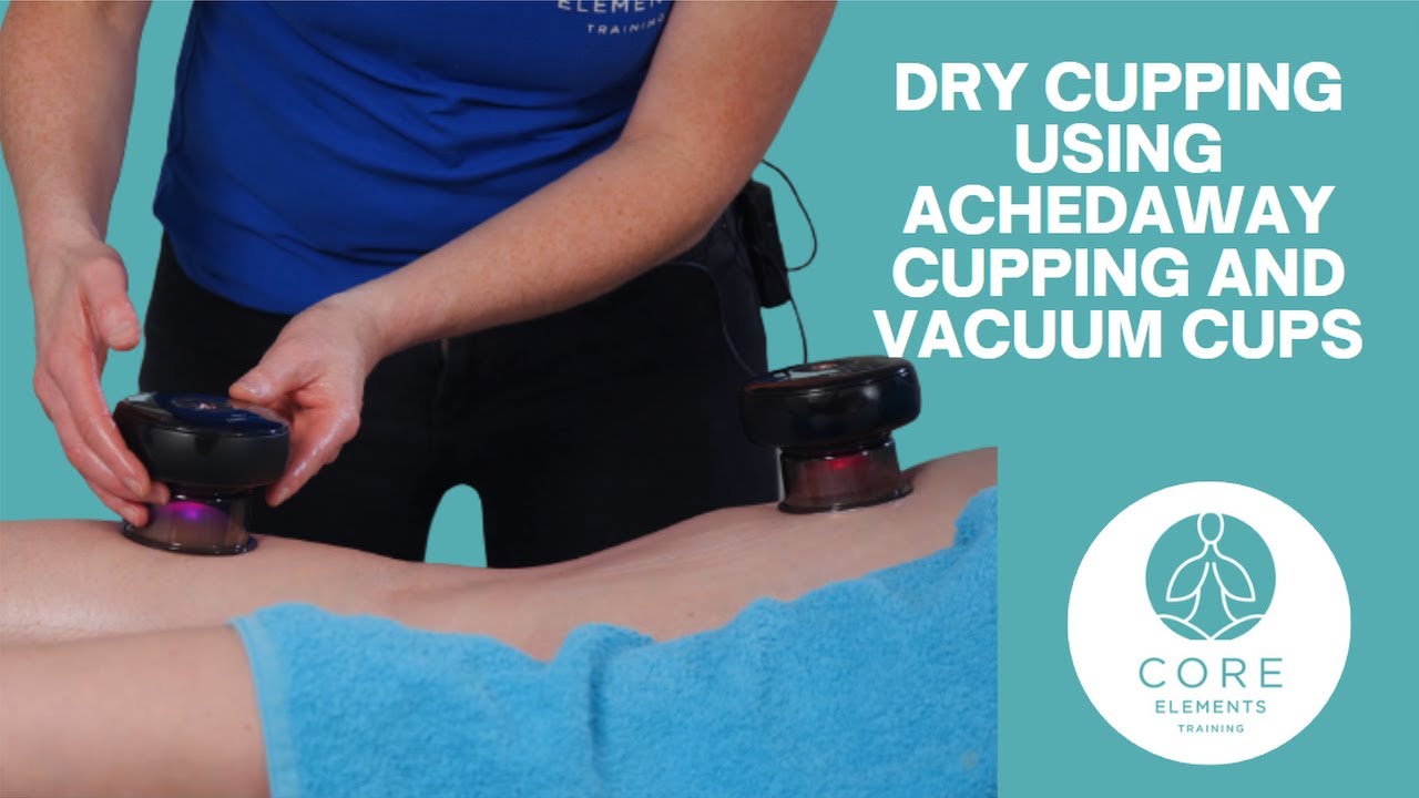 Clinical Dry Cupping with Achedaway and Vacuum Cups - YouTube